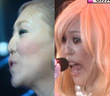 【現在画像】KEIKOがマスクをしている5つの理由は？ネットの噂をまとめてみた！ | すき間産業ぶろぐ あれこれ知りたい